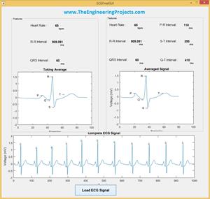 eye ball detection in matlab - The Engineering Projects